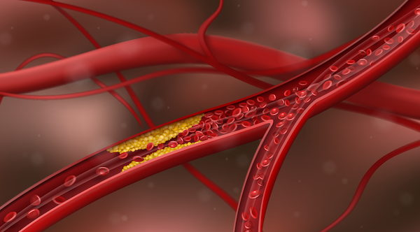 ApoB: What is ApoB and Why Do We Care? | Biohackr Health